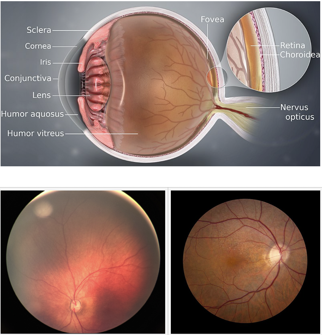 Services – Pier Vision Optometry: Eye Exams, Contact Lenses, Emergency ...